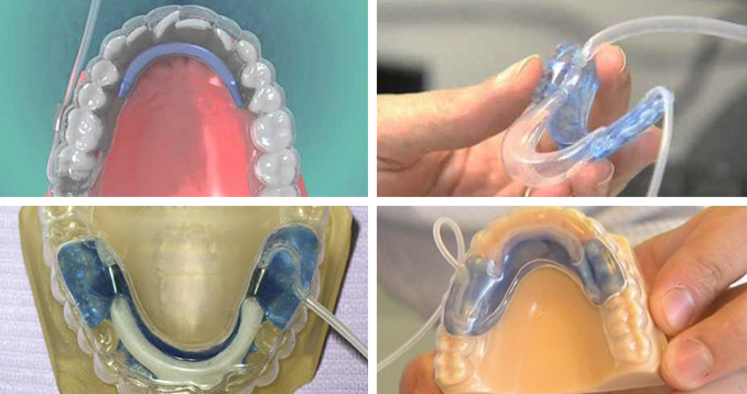 Ortodontia Archives - BLOG DO DENTISTA